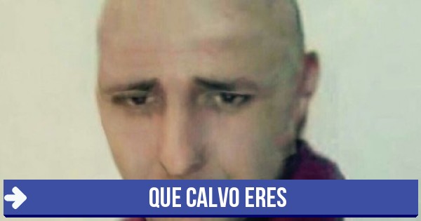 Test: Que calvo eres